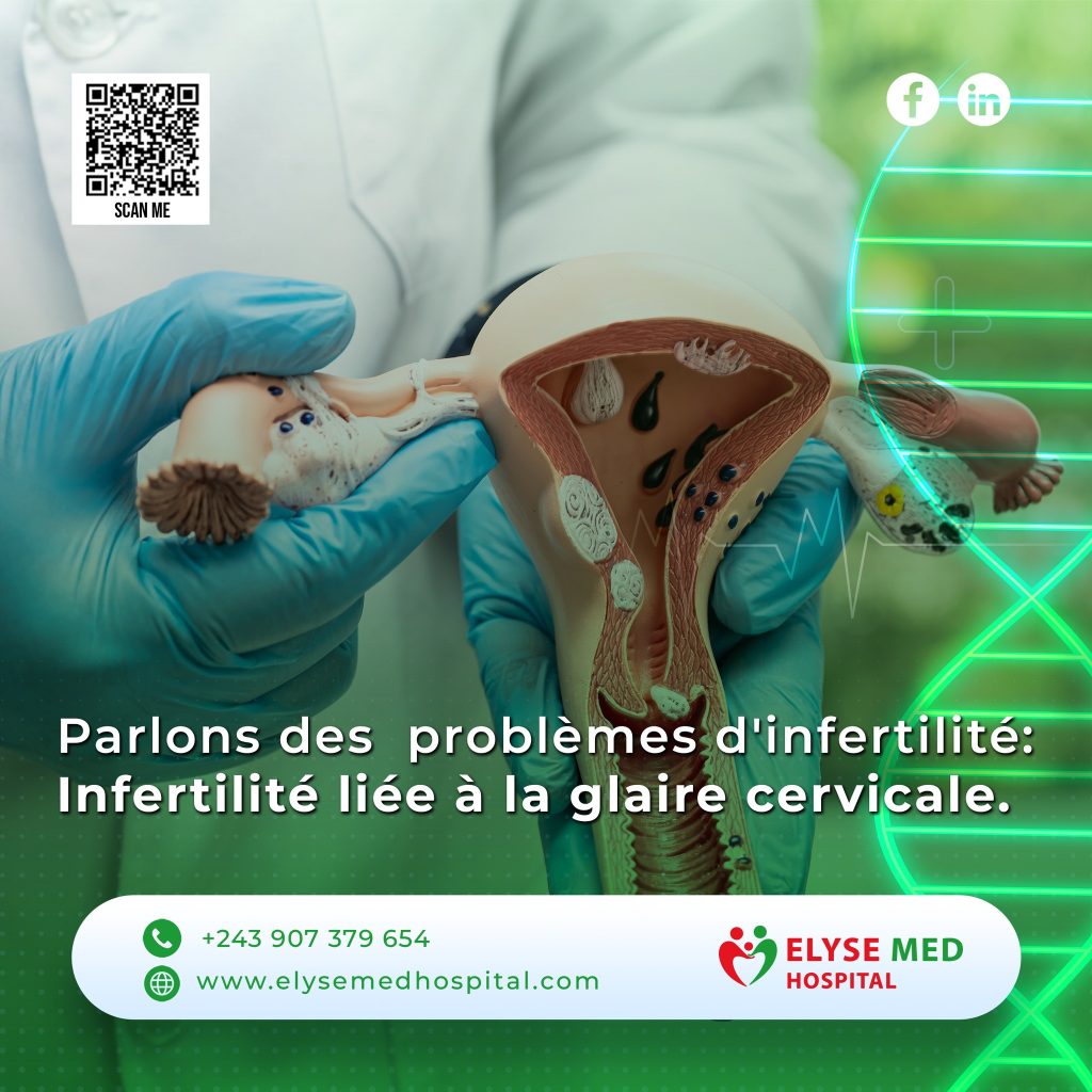 Parlons Des Problèmes D'infertilité Liés à La Glaire Cervicale ...